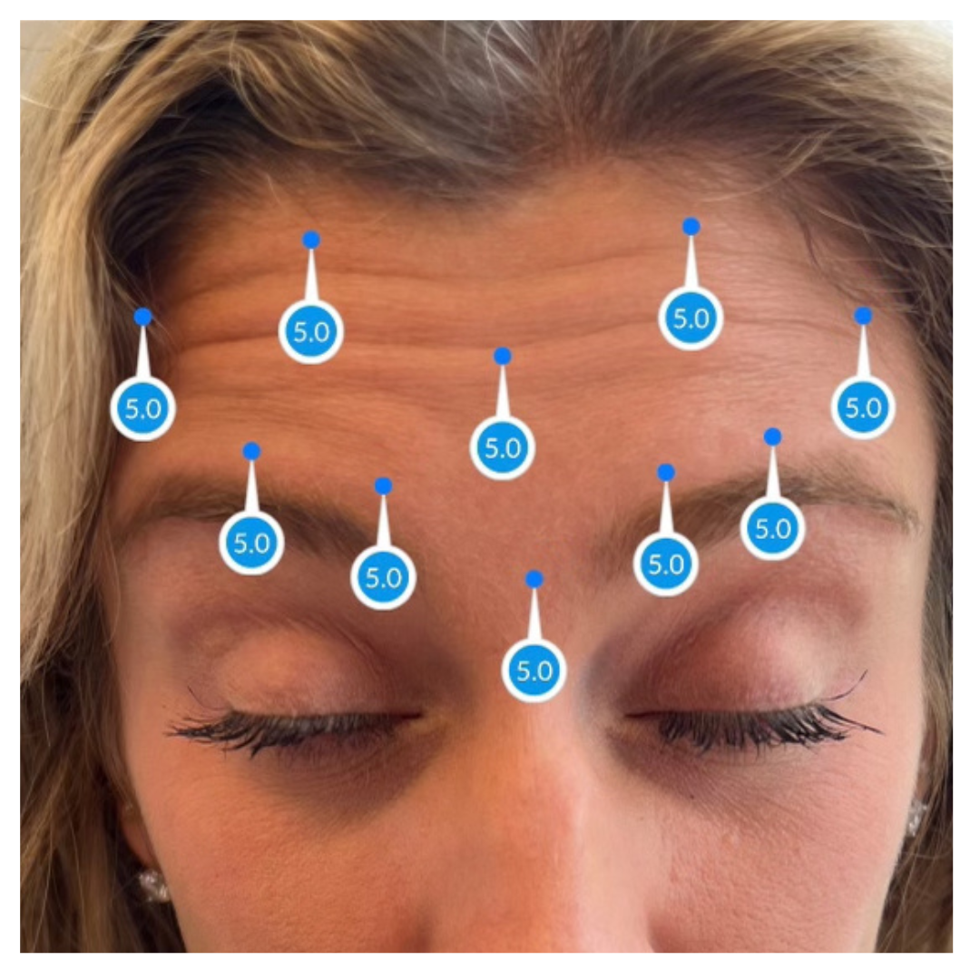 The Best Botox Naples FL | Facial Injection Treatments - The Wellness ...