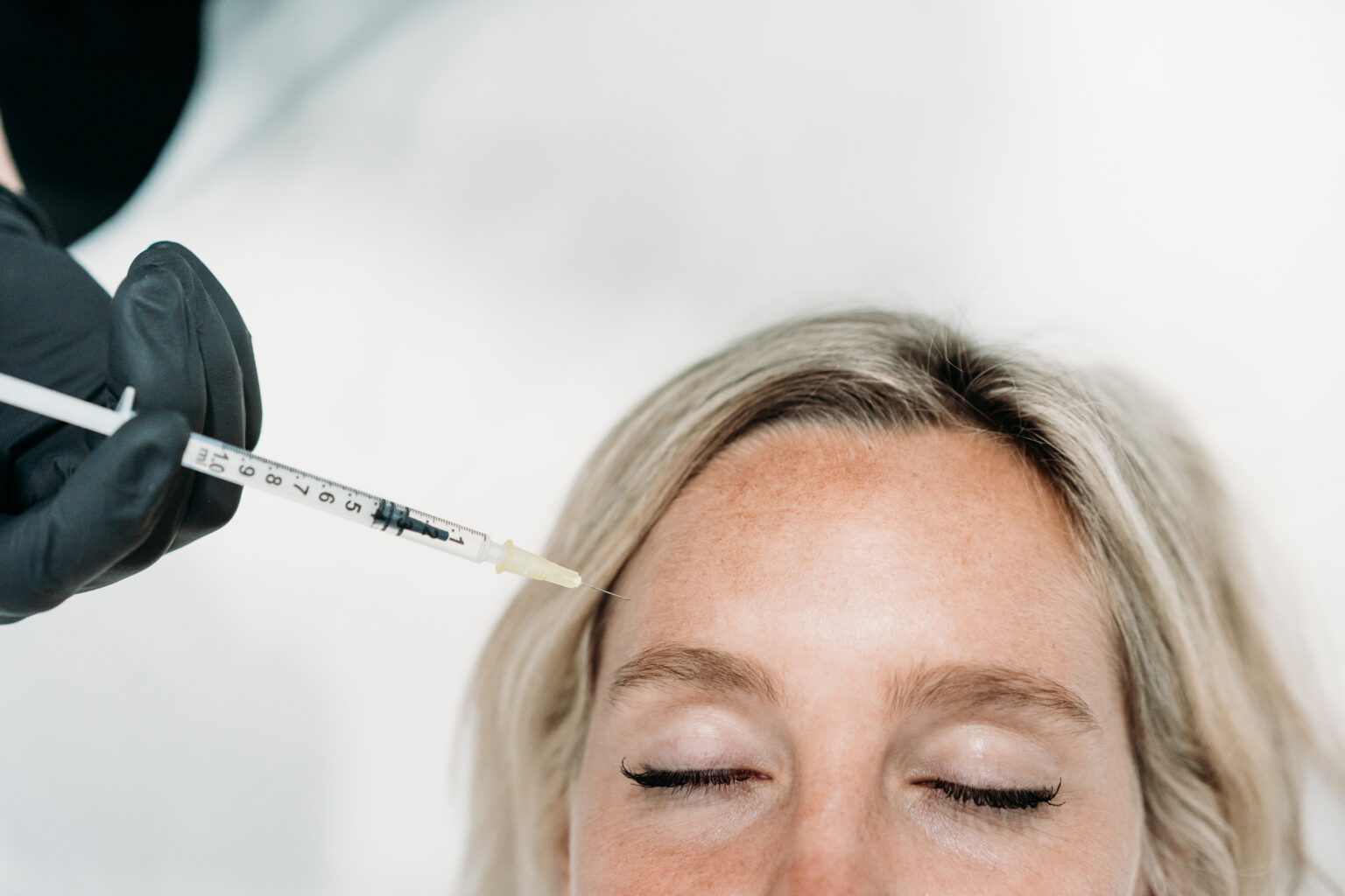Botox in Naples, FL – Smooth, Youthful Skin Starts Here at The Wellness ...