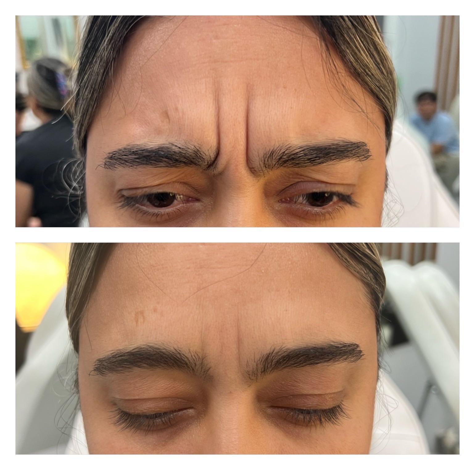 Botox in Naples, FL – Smooth, Refresh, and Rejuvenate with The Wellness ...